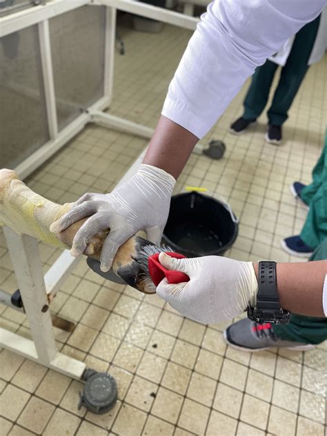 Digit Amputation Cmap