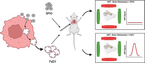 Using Extracellular Vesicles To Tackle Brain Metastases In Breast Cancer Exosome Rna