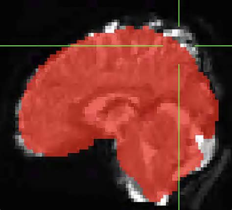 Fmriprep Preprocessing Functional Data Does Not Align With Anatomical