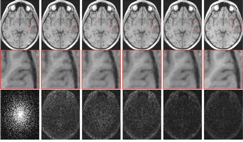 Reconstruction Results Of 6x Accelerated Data SNR DB Values Are Download Scientific Diagram