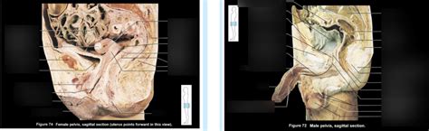 Cadaver Of Male And Female Reproductive Anatomy Diagram Quizlet