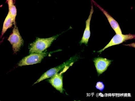 常规免疫组化及荧光免疫组化protocol 5 6 知乎