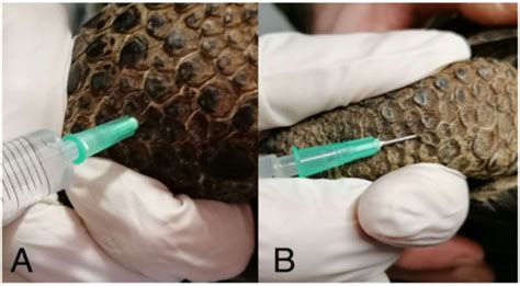 Comparison Of Subcutaneous Versus Intramuscular Dexmedetomidine