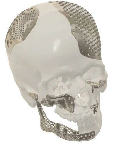 Titanium Cranial Implant At ₹ 45000piece In Bengaluru Id 2852080492112