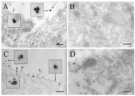 Immunogold Electron Microscopy Antibodies At Quentin Davis Blog