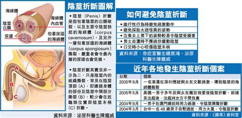 七人做愛出事 三人自瀆受傷 7年10人性事中折斷陰莖 蘋果日報•聞庫