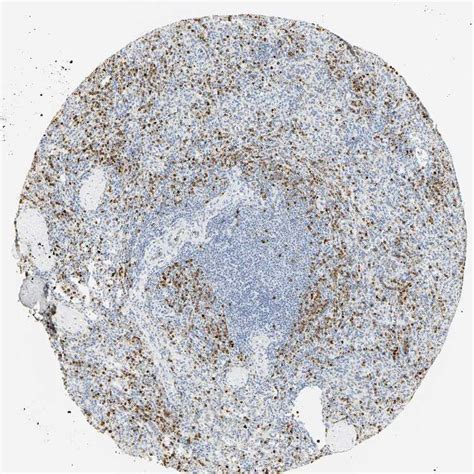 Tissue Expression Of Mpo Staining In Spleen The Human Protein Atlas