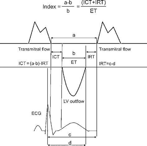 Schematic Presentation Of The Doppler Derived Myocardial Performance Download Scientific