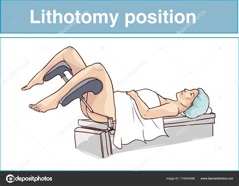 Images Lithotomy Position Vector Illustration Of A Lithotomy