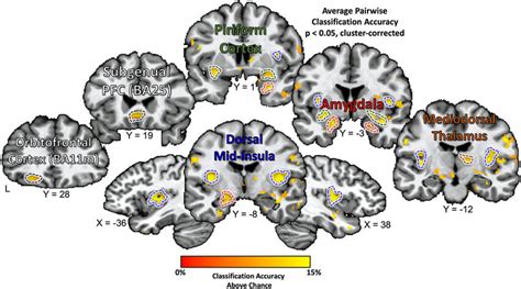Multivariate Pattern Analyses Decode Taste Quality Within Brain Regions Download Scientific