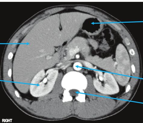 Diagram Of 2227 Ct Abdo Quizlet