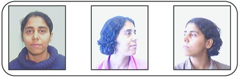 5 intra class variation associated with an individual s face images