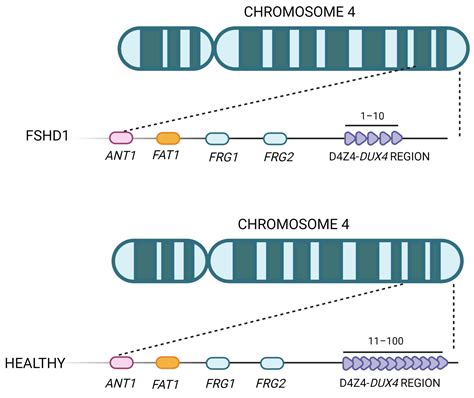 Influence Of Dux4 Expression In Facioscapulohumeral Muscular Dystrophy