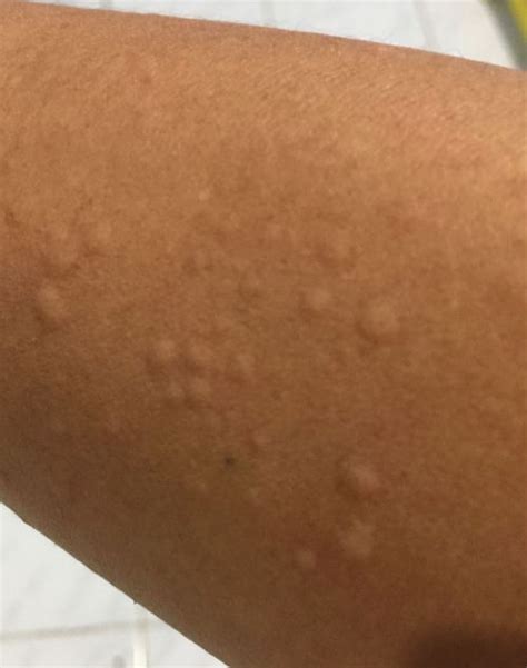 Daun Gatal Obat Tradisional Papua Berbagi Tak Pernah Rugi