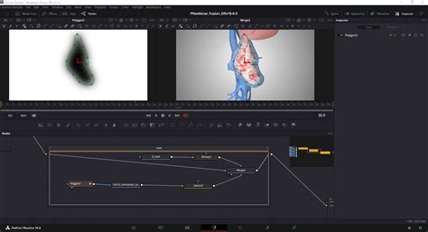 Node Based Compositing With DaVinci Resolves Fusion TVASurg The Toronto Video Atlas Of Surgery