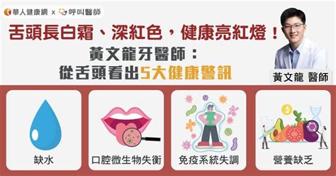 舌頭長白霜、深紅色，健康亮紅燈！黃文龍牙醫師：從舌頭看出4大健康警訊 華人健康網 專業即時優質的健康新聞及資訊分享平台業即時優質的健康