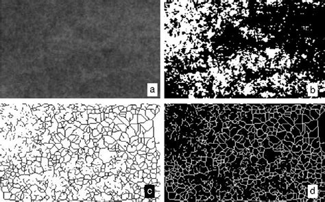Image Processing For Fractal Analysis A Original Image B Binary Download High Quality