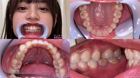 Shion Yumi Watching Inside Mouth Of Japanese Cute Girl 1080p Japanese Asian Biting Mouth