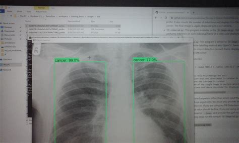 Github Anpham100aiml Esmail Tensorflow Cancer Object Detection Its