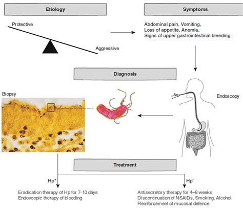 Peptic Ulcer Disease Metabolism Of Human Diseases