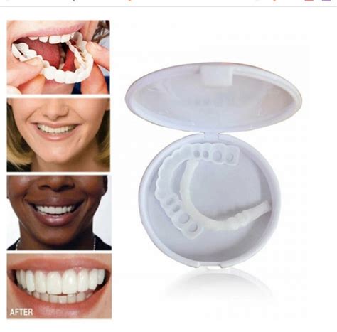 Купить Накладные зубы виниры TruSmile на верхнюю челюсть в Минске от ...