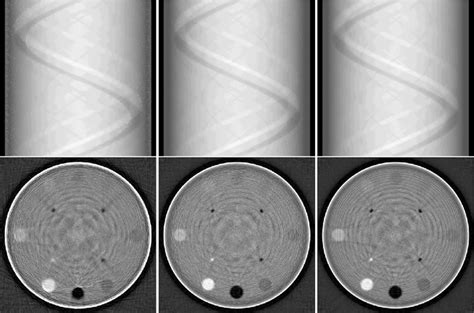 Sinogram Upper Row And Reconstructed Image Bottom Row Of The Ctp404