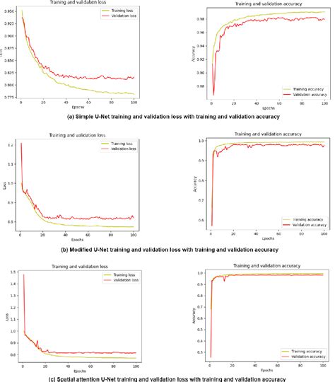 Figure 7 From Brain Tumor Segmentation Using The Modified Unet