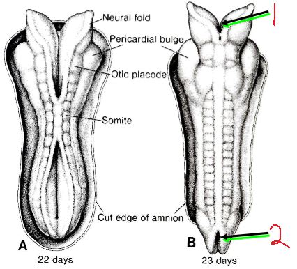 Lecture Flashcards Quizlet Lecture Flashcards Quizlet
