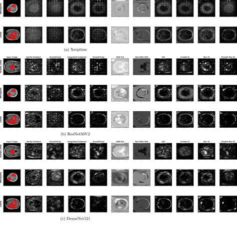 Figure 8 From Visual Interpretable And Explainable Deep Learning Models