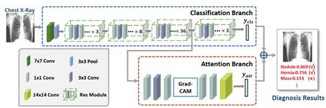 Thorax Net An Attention Regularized Deep Neural Network For