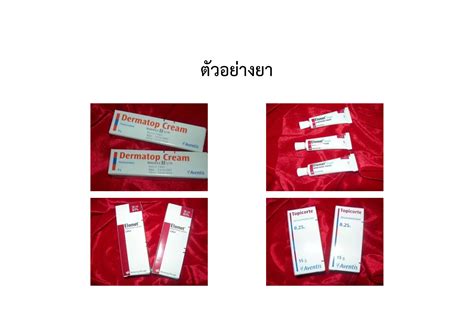 Topical Corticosteroids Pdf