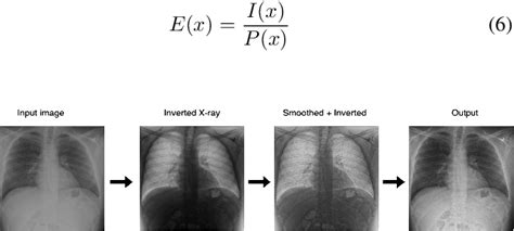 figure 1 from unsupervised iterative u net with an internal guidance