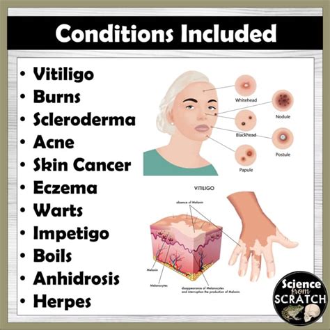 Integumentary System Disorders And Diseases Stations By Science From