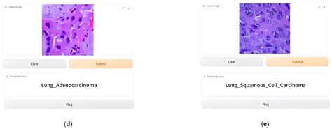 An End To End Lightweight Multi Scale Cnn For The Classification Of