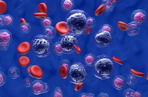 Targeted Therapy For Leukaemia Subtype Approved In Eu
