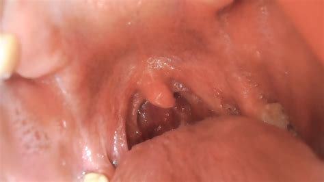 Giant Drevon Shrunken Servitude Drevon The Colossus Clips Sale