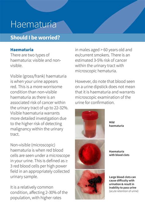 What Causes Spindle Cell Neoplasm