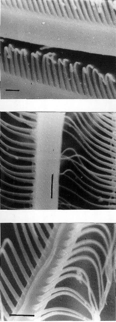 Scanning Electron Micrographs Showing Detail From The Terminal Setae Of