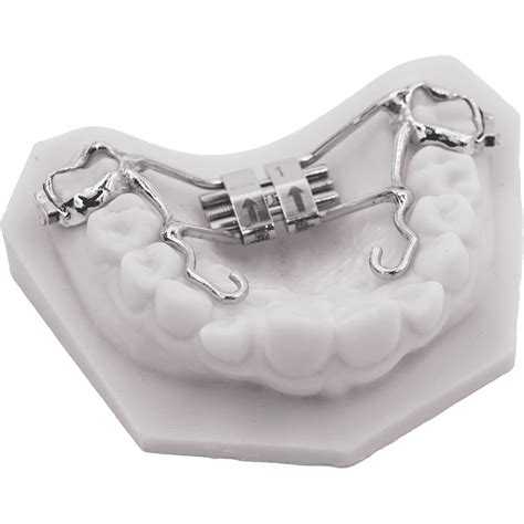 Infinity Rpe Innovative 3d Printed Rapid Palatal Expanders