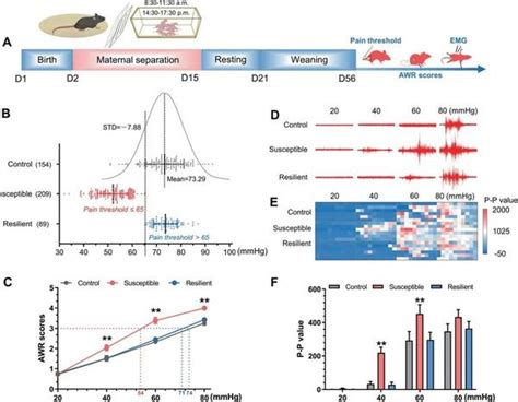 【客户文章】徐州医科大学张咏梅教授团队揭示avbnst Pvn神经环路介导生命早期应激致成年慢性内脏痛易感性的机制 知乎