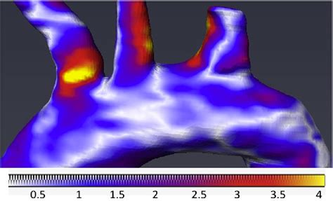 Three Dimensional View Of The Elastic Registration Results Of The