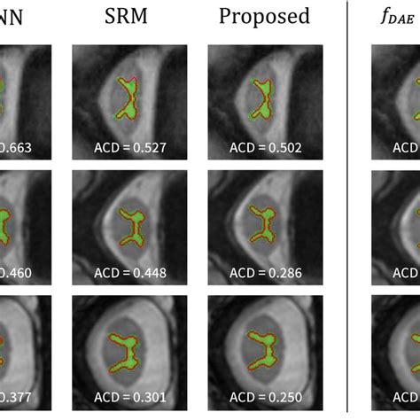 Architecture Of The Denoising Convolutional Autoencoder Dae