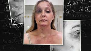 Virginia Giuffre Cause Of Death Epstein Survivor And Prince Andrew