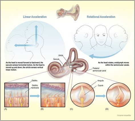 Benign Paroxysmal Positional Vertigo Benign Paroxysmal Positional