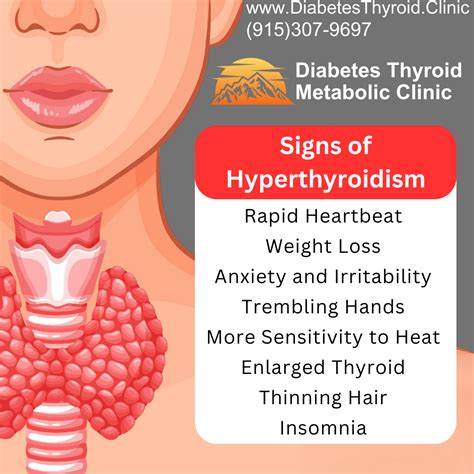 Hyperthyroidism Diabetes And Thyroid Metabolic Clinic
