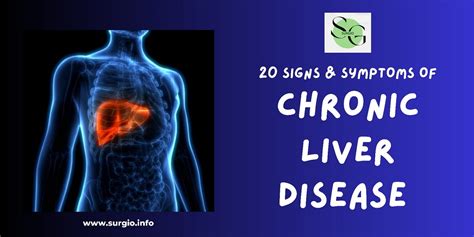 Chronic Liver Disease Clinical Case Presentation By Anfal Hamza Medium