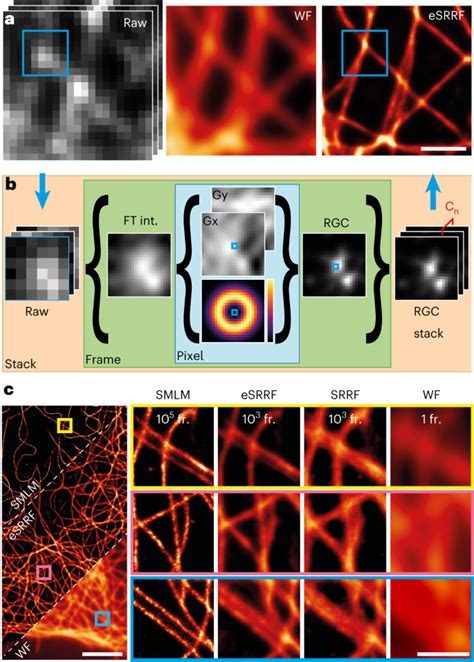 通过数据驱动的增强超分辨率径向波动进行高保真 3d 活细胞纳米显微镜 Nature Methods X Mol