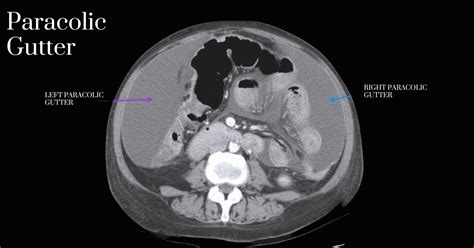 7 Japanese Techniques To Overcome Laziness By Health Sphere Medium