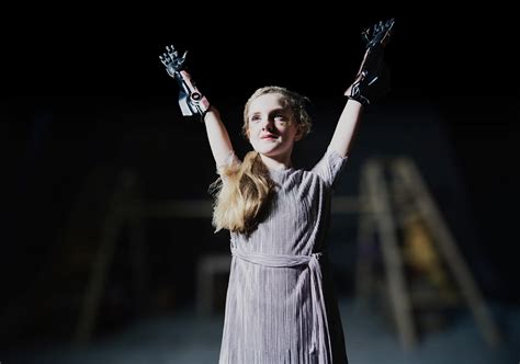 Bionic Prosthesis On Behance