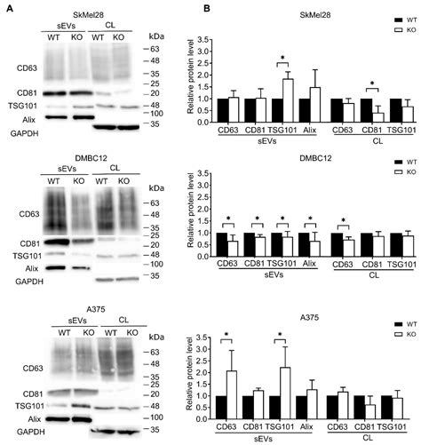 Impact Of Rab27 On Melanoma Cell Invasion And Sev Secretion